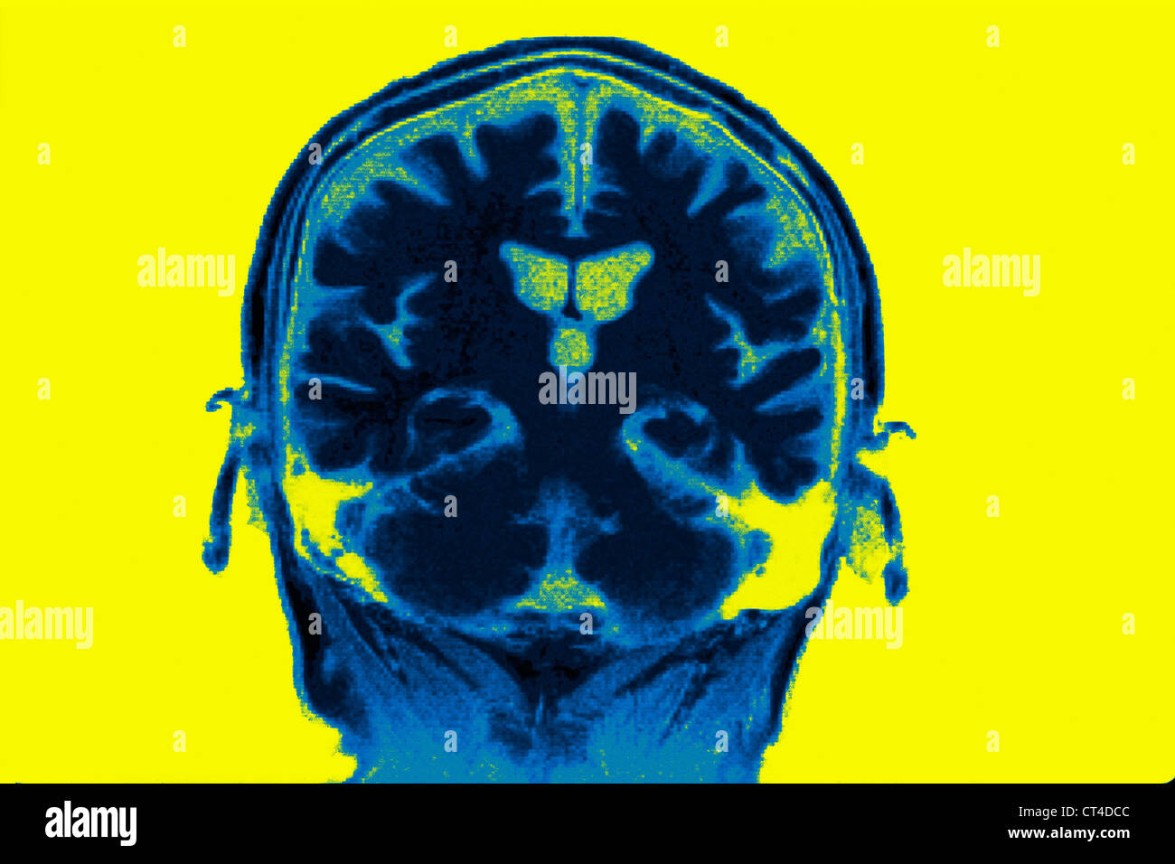 Memory system hi-res stock photography and images - Alamy