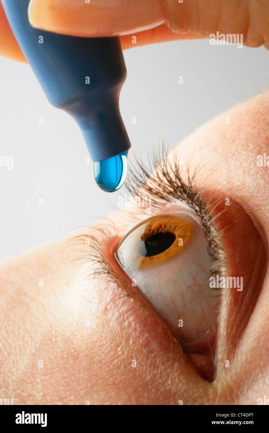 WOMAN USING EYE LOTION Stock Photo - Alamy