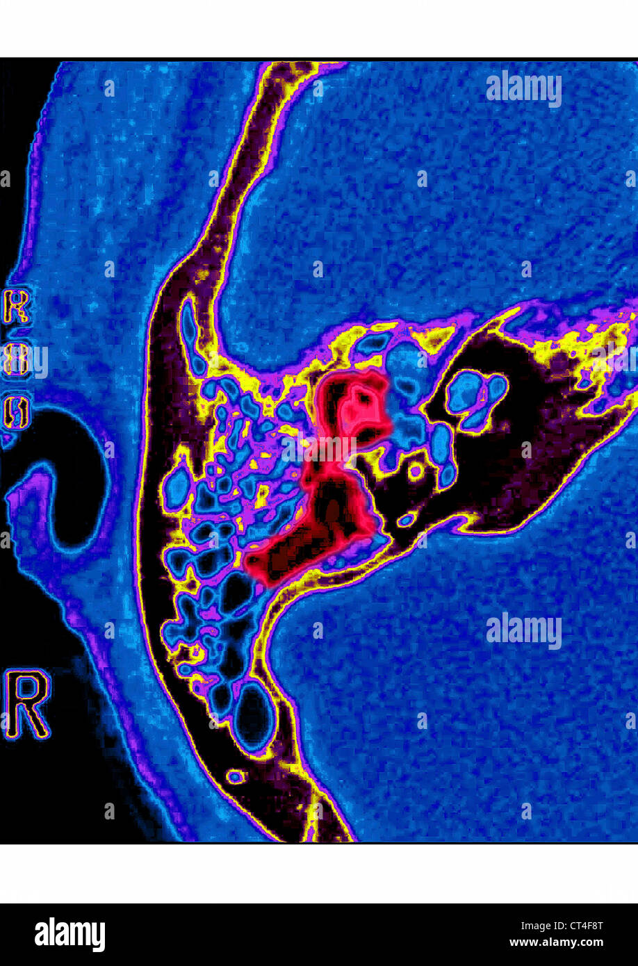 Nose examination ent examination ent examinations inflammation inflame ...