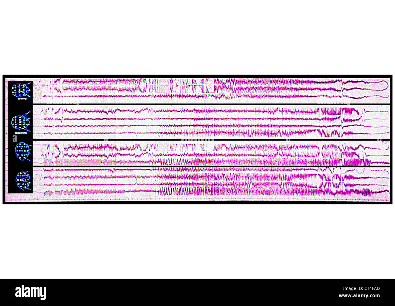Eeg trace hi-res stock photography and images - Alamy