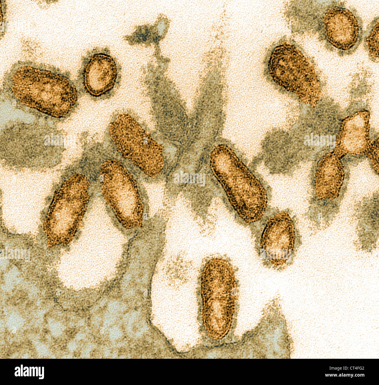 SPANISH FLU INFECTION Stock Photo - Alamy