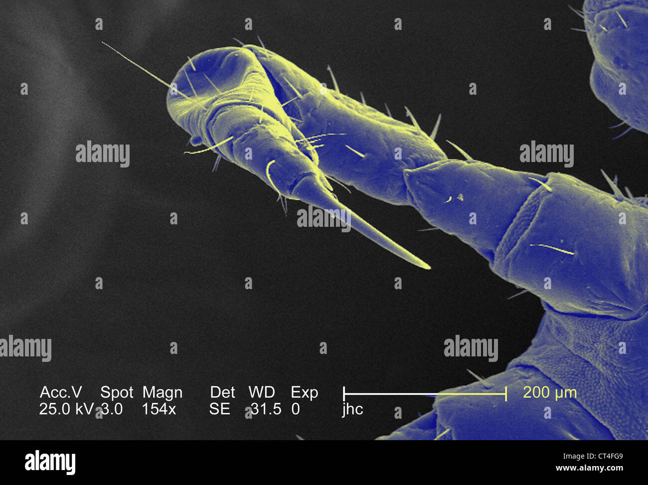LOUSE LEG, SEM Stock Photo - Alamy