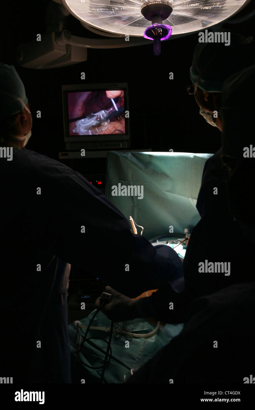 Gallbladder examination hi-res stock photography and images - Alamy