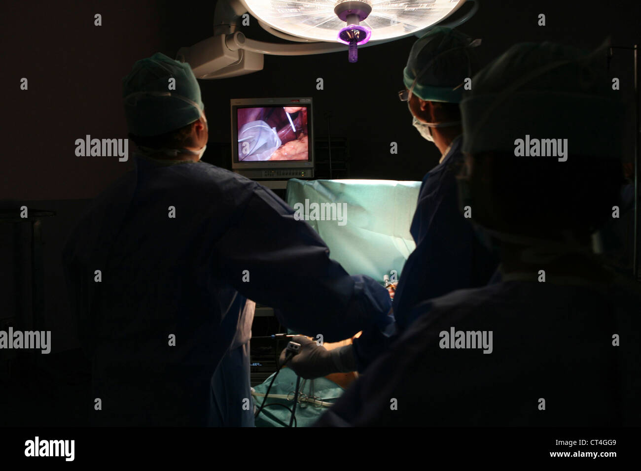 Laparoscopy gallbladder hi-res stock photography and images - Alamy