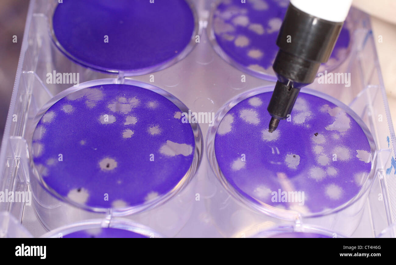 Titration plate hi-res stock photography and images - Alamy