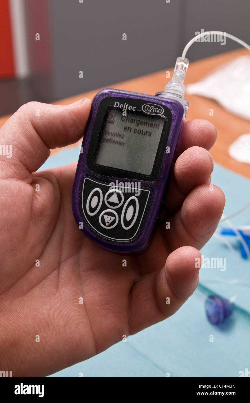 EXTERNAL INSULIN PUMP Stock Photo - Alamy