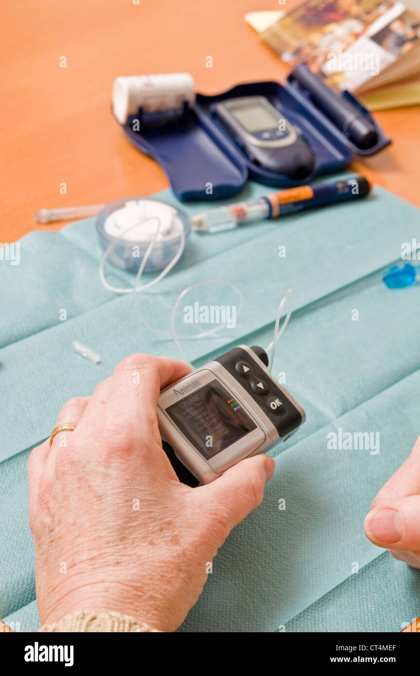 EXTERNAL INSULIN PUMP Stock Photo - Alamy