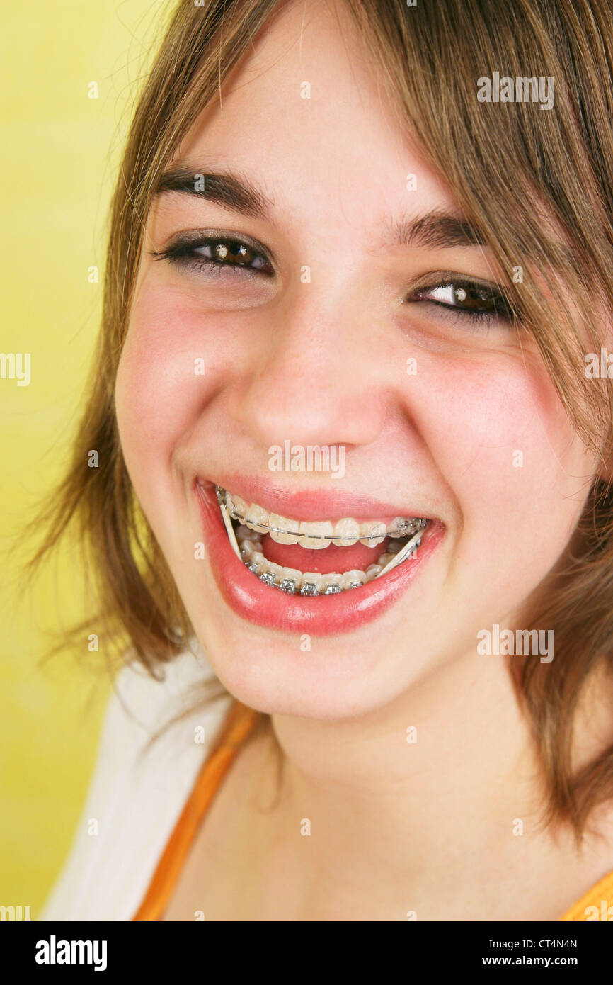 Giggle laugh laughing teeth hi-res stock photography and images - Alamy