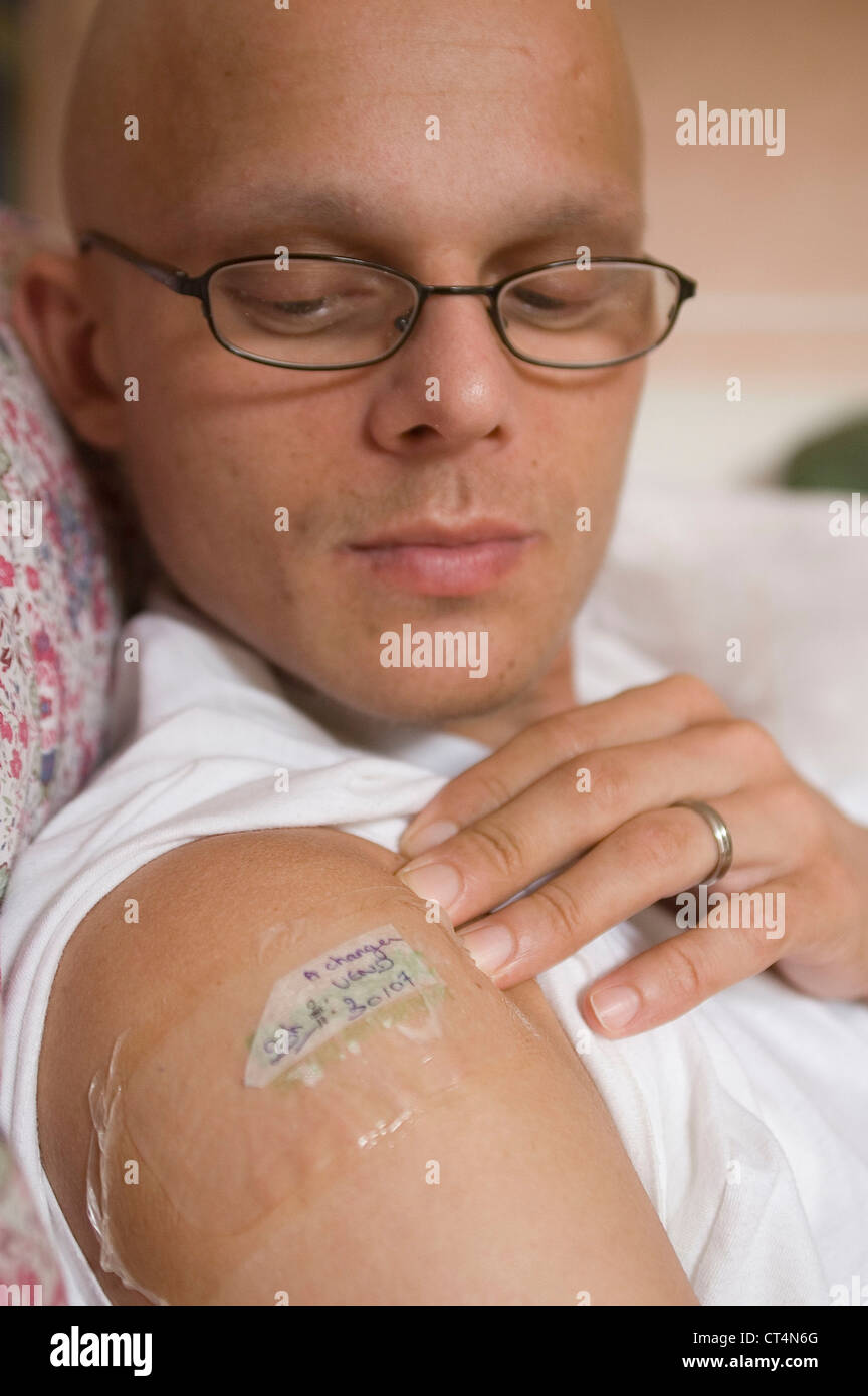 Testis cancer hi-res stock photography and images - Alamy