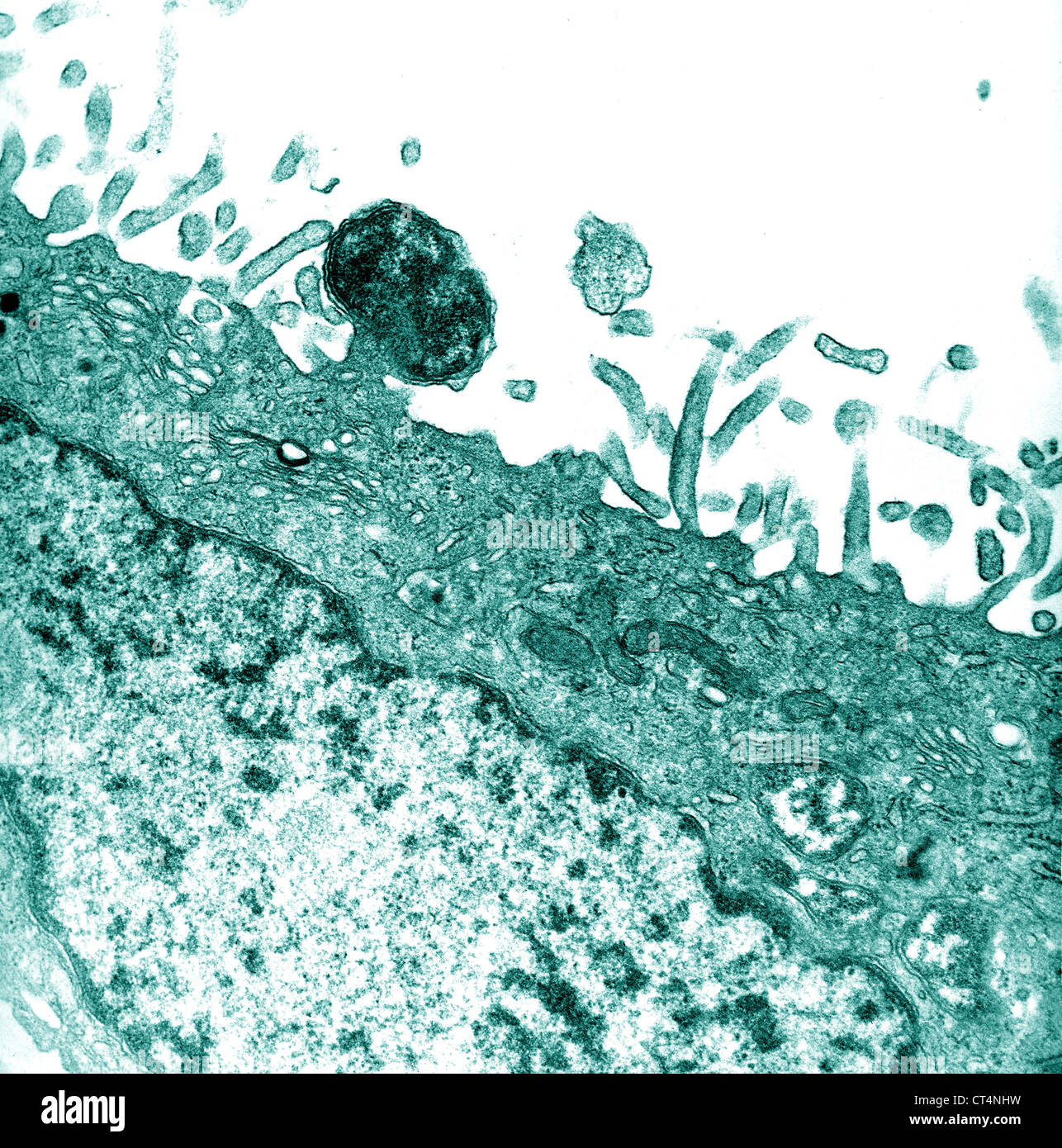Orientia tsutsugamushi hi-res stock photography and images - Alamy