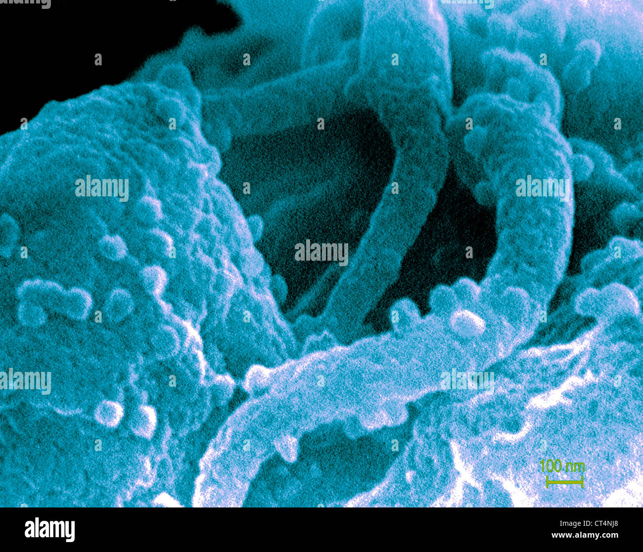 AIDS VIRUS INFECTION, SEM Stock Photo - Alamy
