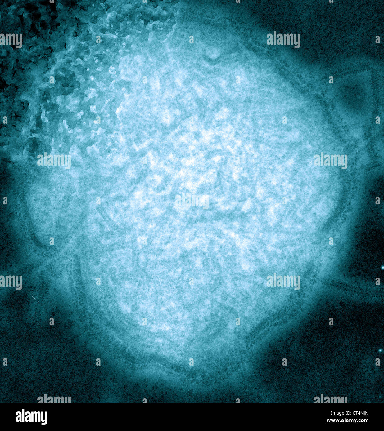 Mumps virus hi-res stock photography and images - Alamy