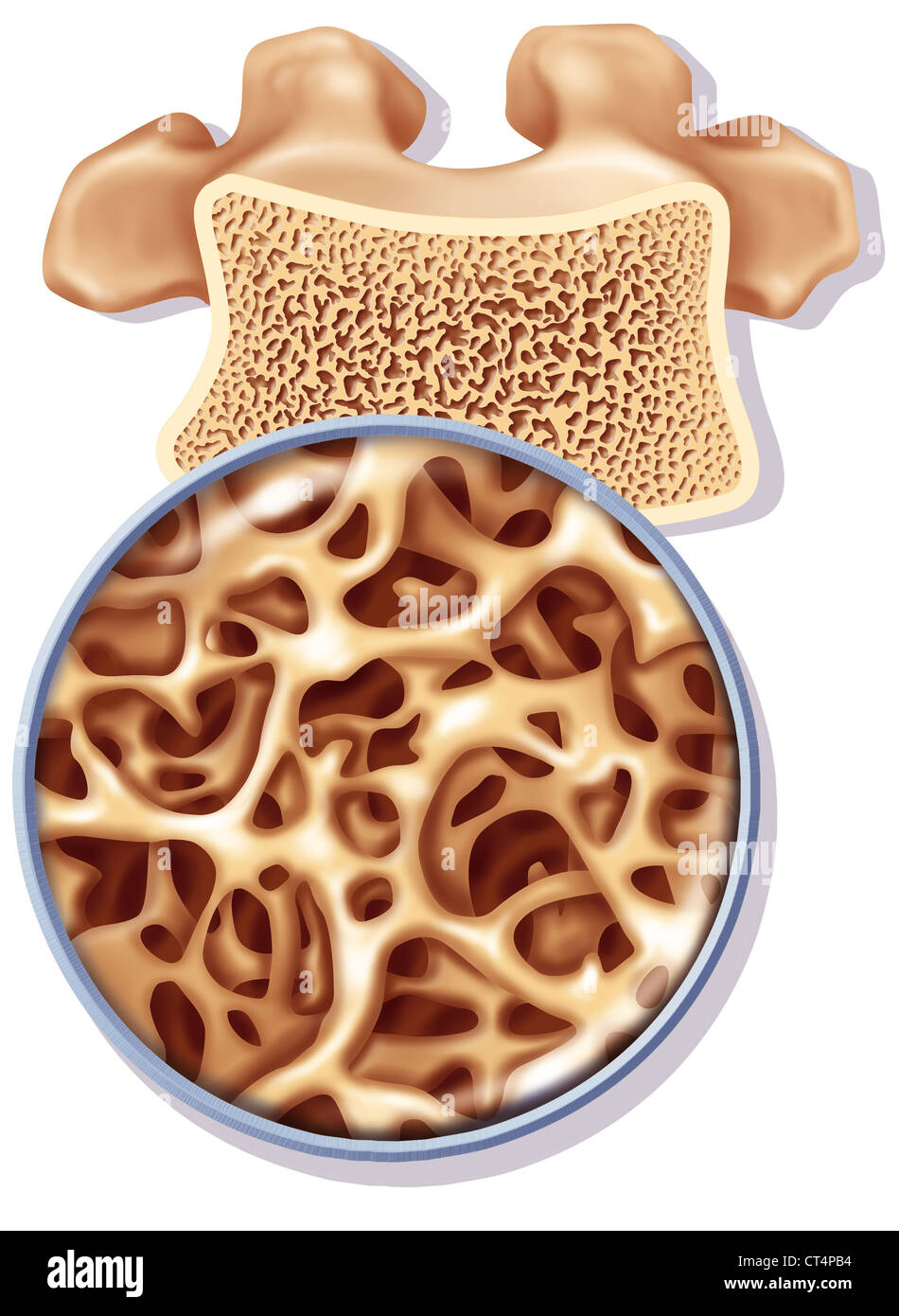 Cancellous and compact bone hi-res stock photography and images - Alamy