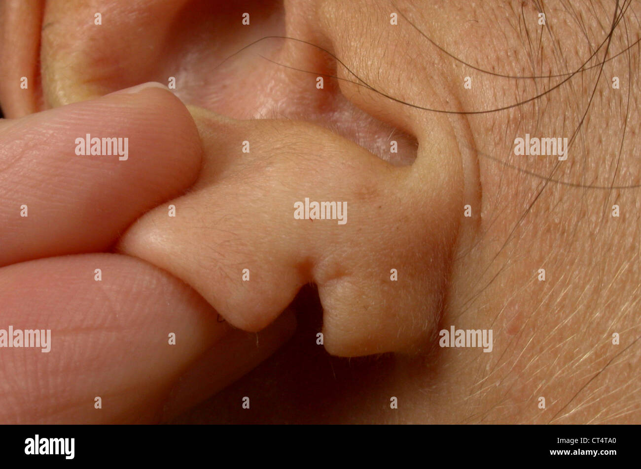 Ear lobes closeup hi-res stock photography and images - Alamy