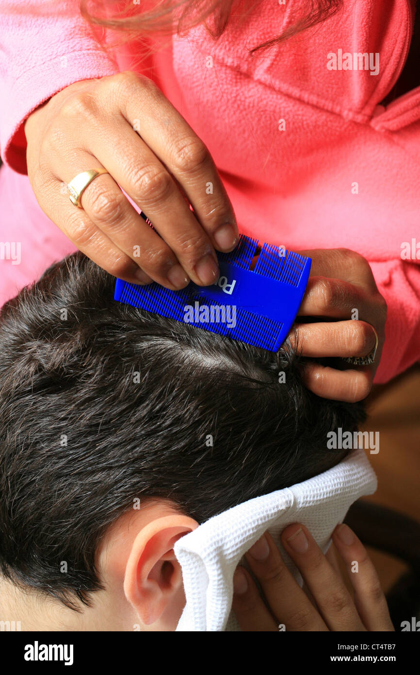 TREATMENT FOR LICE Stock Photo - Alamy