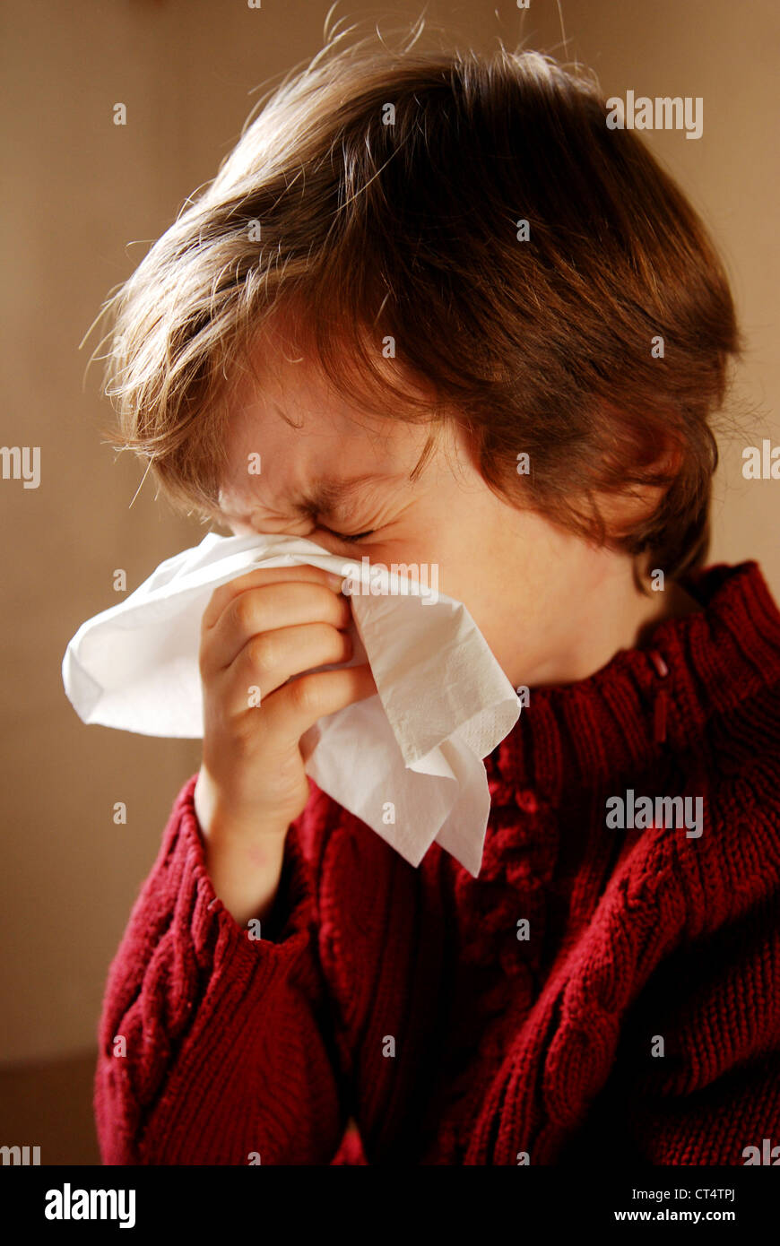 CHILD WITH RHINITIS Stock Photo - Alamy