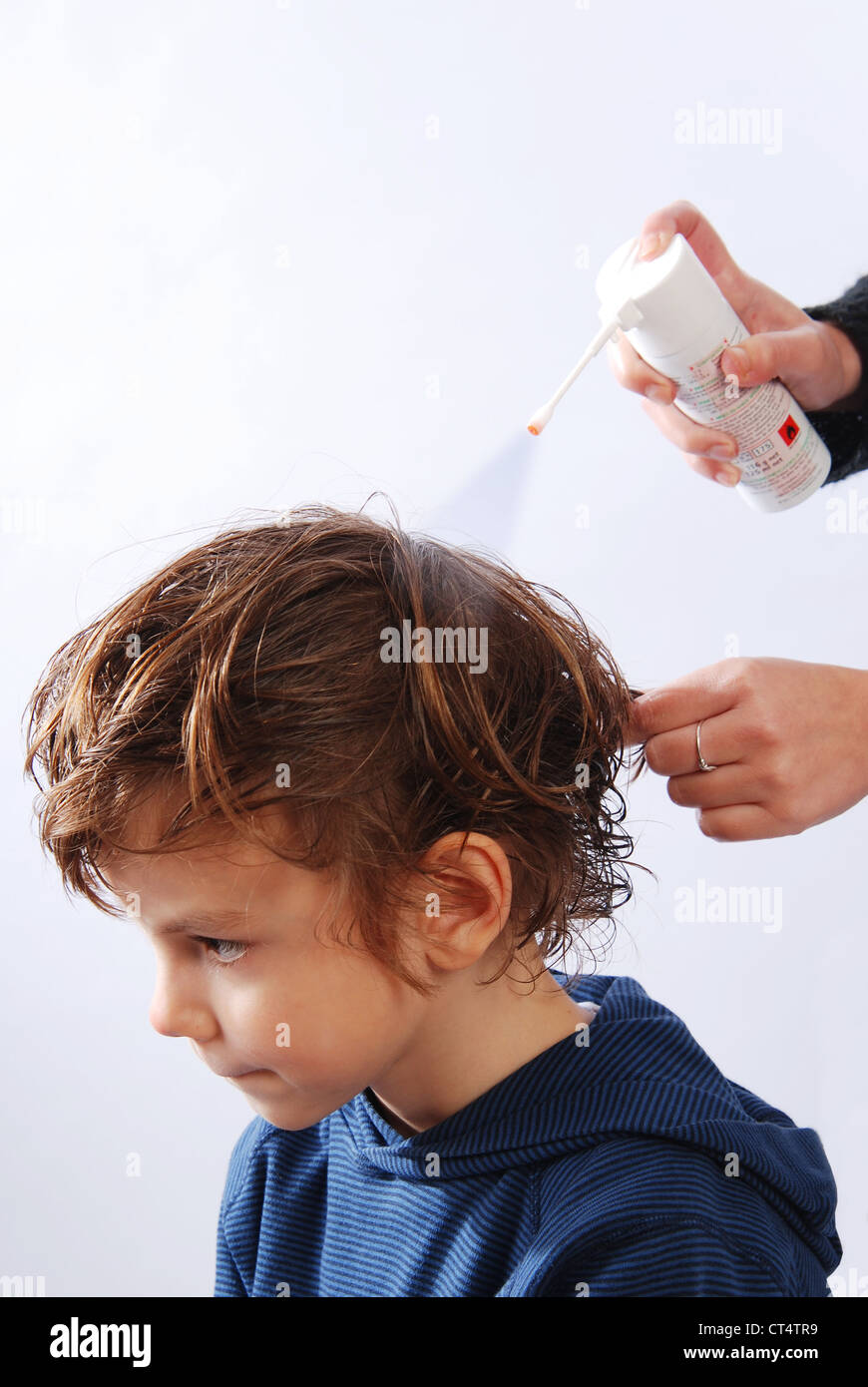 TREATMENT FOR LICE Stock Photo - Alamy