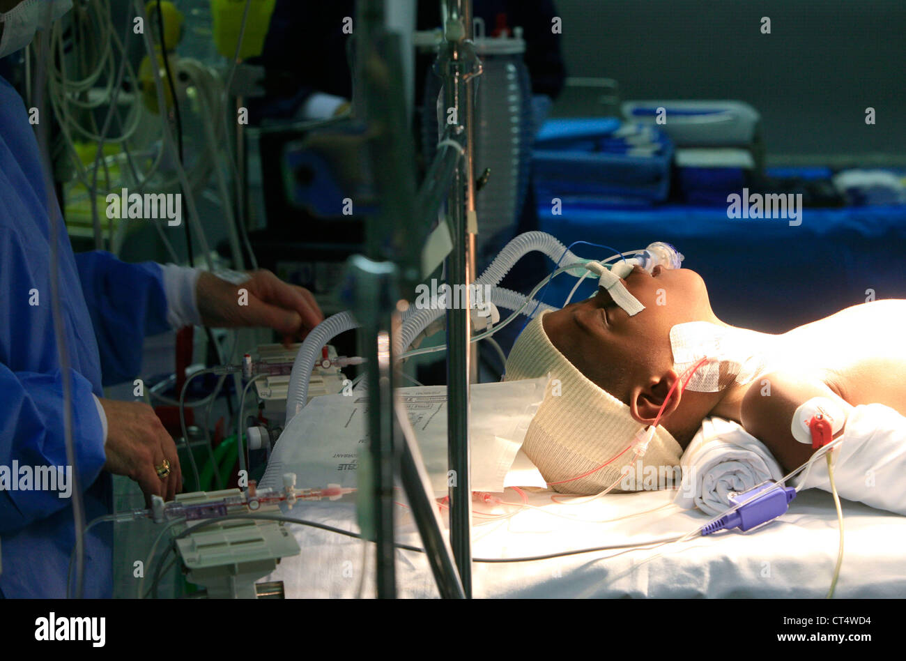 Anesthesia in children hi-res stock photography and images - Alamy