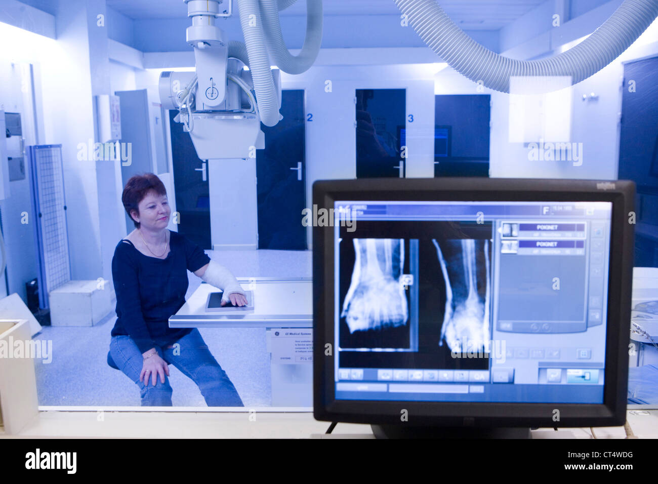 ARM, X-RAY EXAMINATION Stock Photo - Alamy