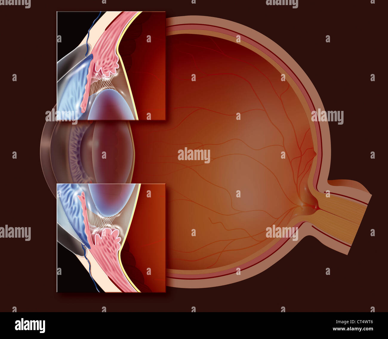 Trabecular meshwork hi-res stock photography and images - Alamy