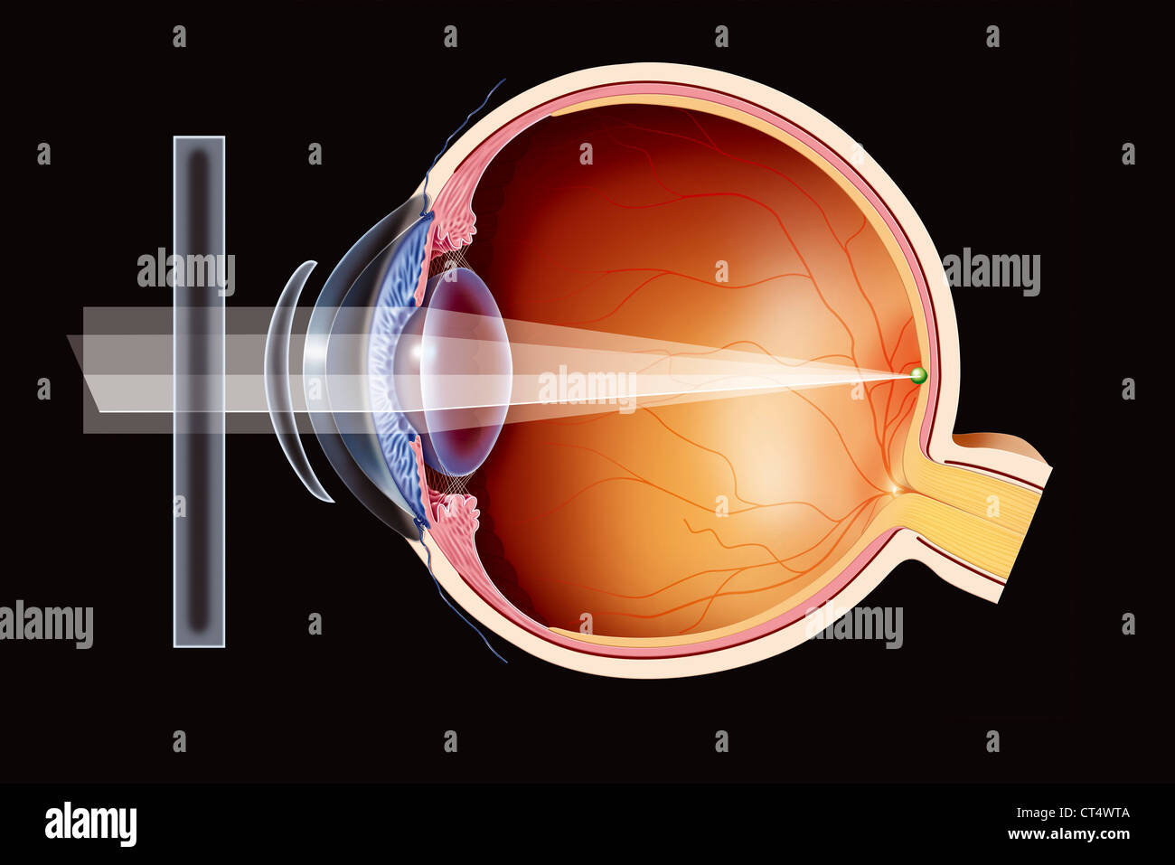 Astigmatism drawing hi-res stock photography and images - Alamy