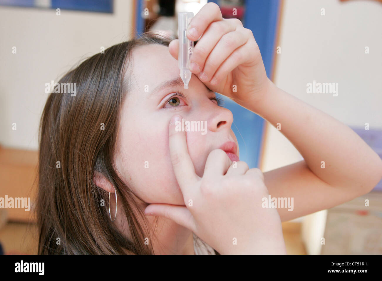 Conjunctivitis child hi-res stock photography and images - Alamy