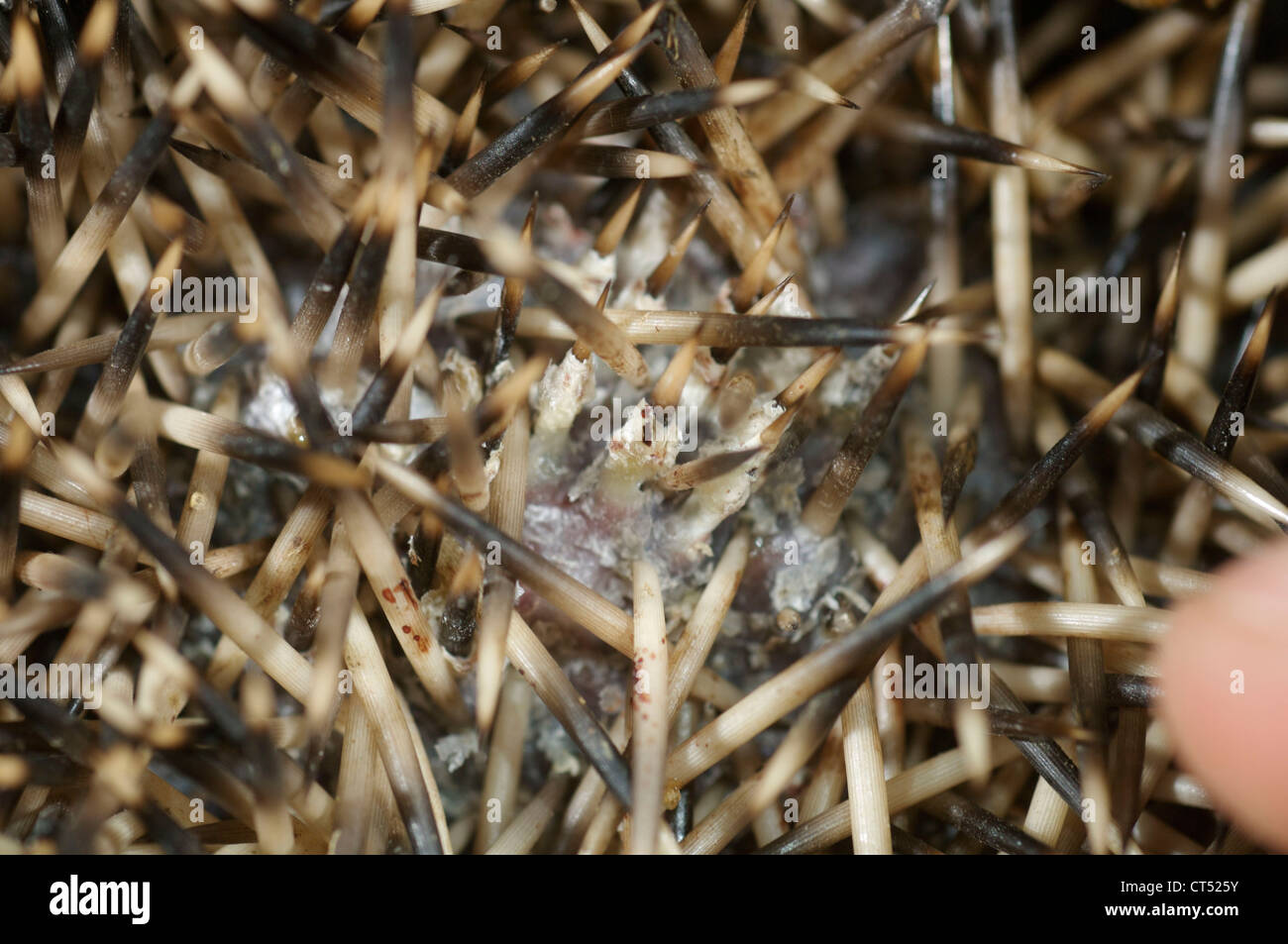 Spine diseases hi-res stock photography and images - Alamy