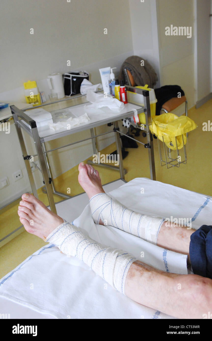 Leg bandages hi-res stock photography and images - Alamy