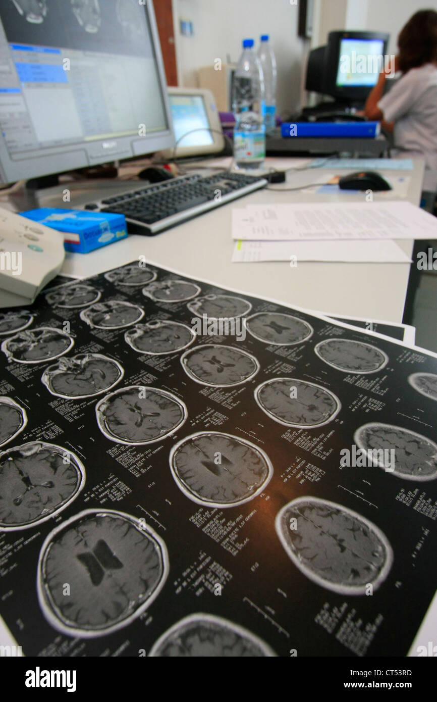 Brain imaging techniques hi-res stock photography and images - Alamy