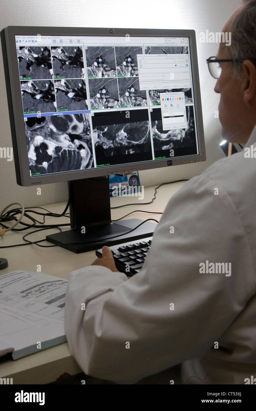 Cranial nerve examination hi-res stock photography and images - Alamy