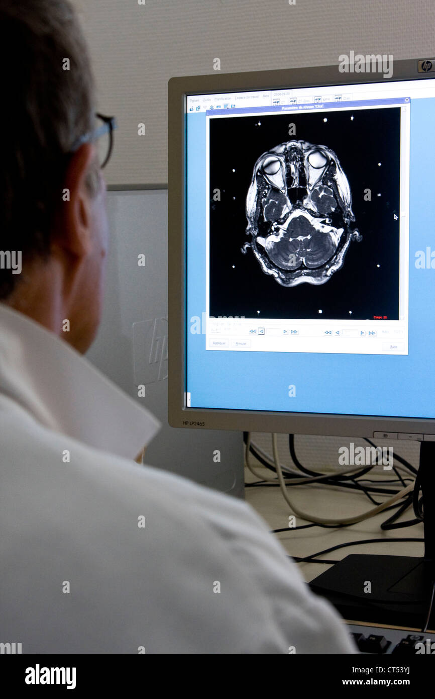 Cranial nerve examination hi-res stock photography and images - Alamy