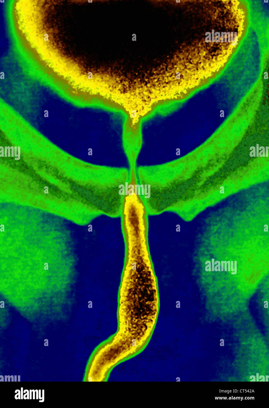 MALE URETHRA, X-RAY Stock Photo - Alamy