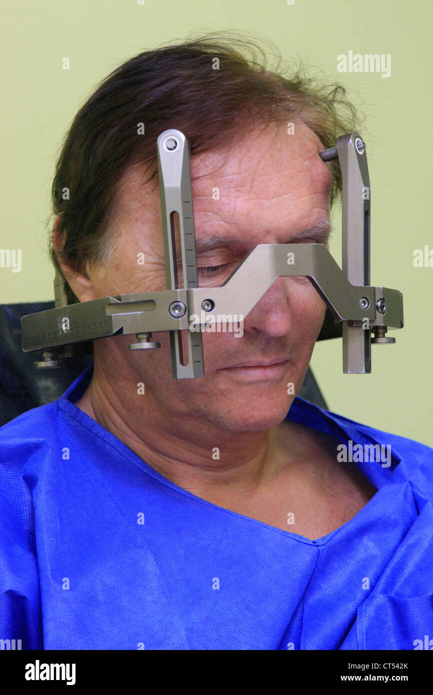 Stereotactic brain surgery hi-res stock photography and images - Alamy