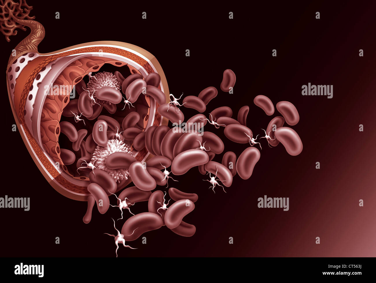 Artery walls hi-res stock photography and images - Alamy