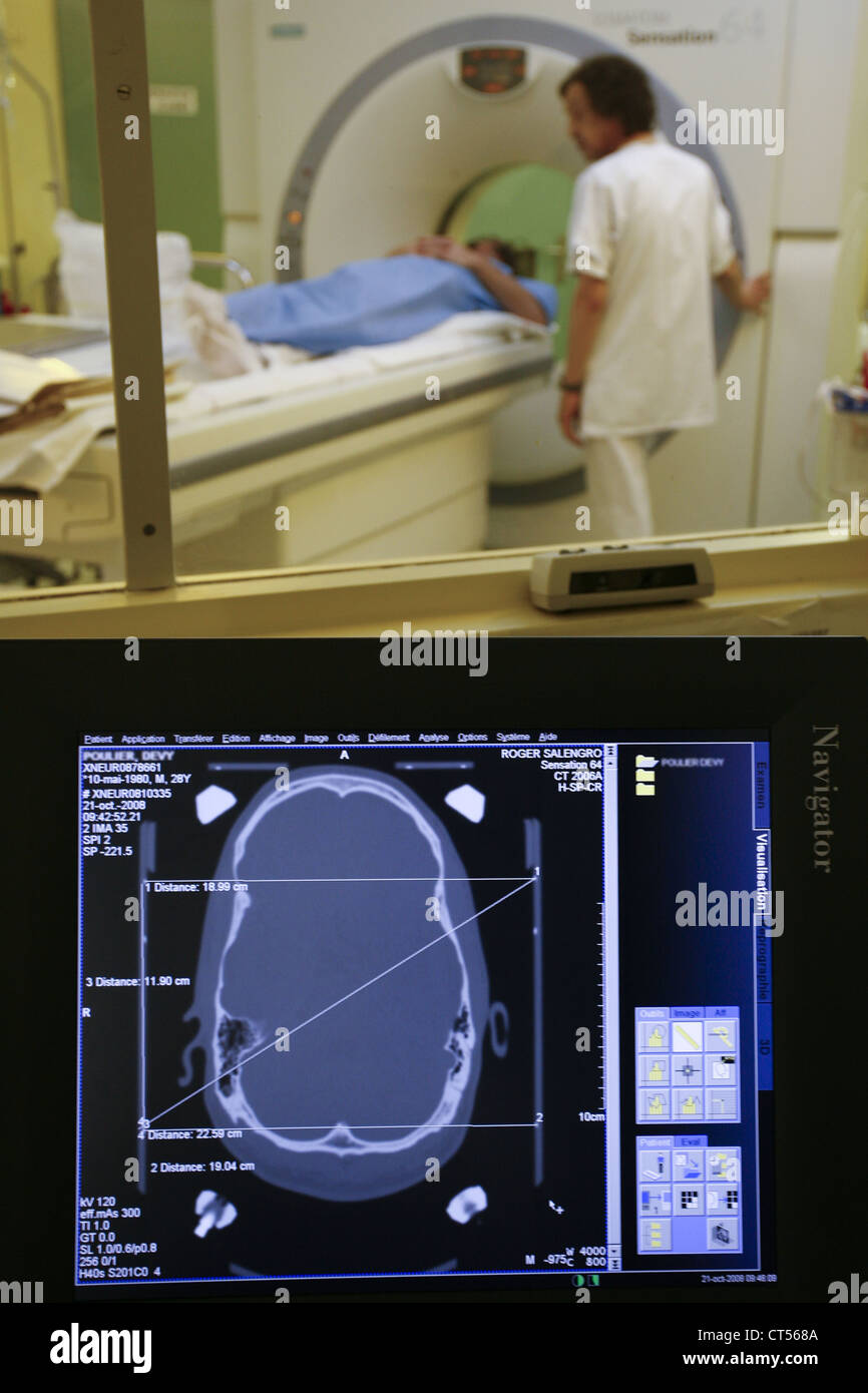 Skull scan hi-res stock photography and images - Alamy