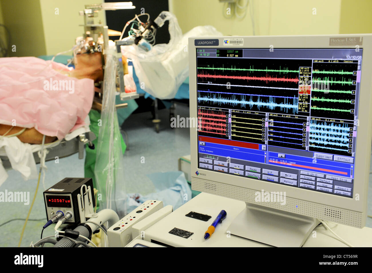 Electrostimulation, brain hi-res stock photography and images - Alamy