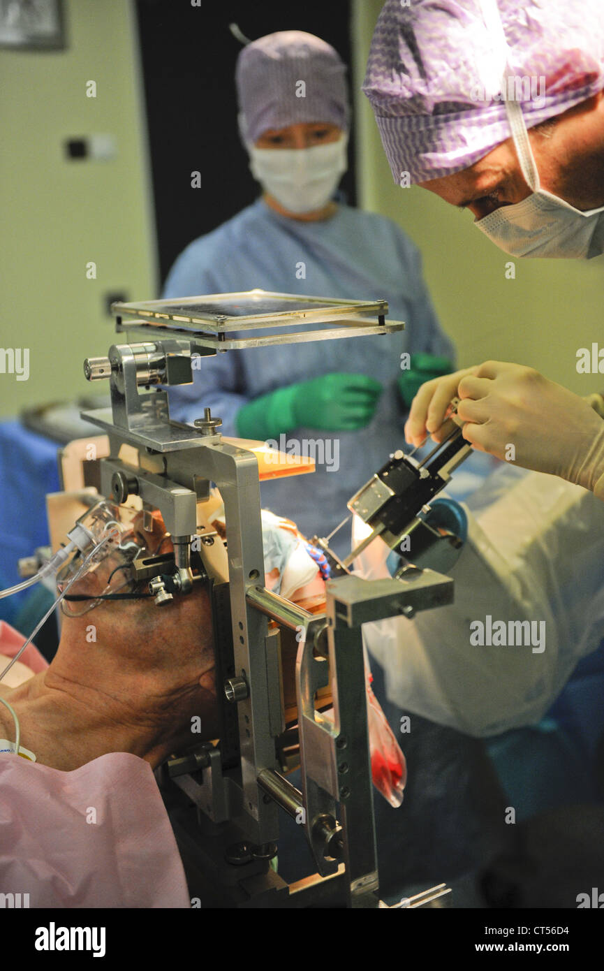 Electrostimulation, brain hi-res stock photography and images - Alamy