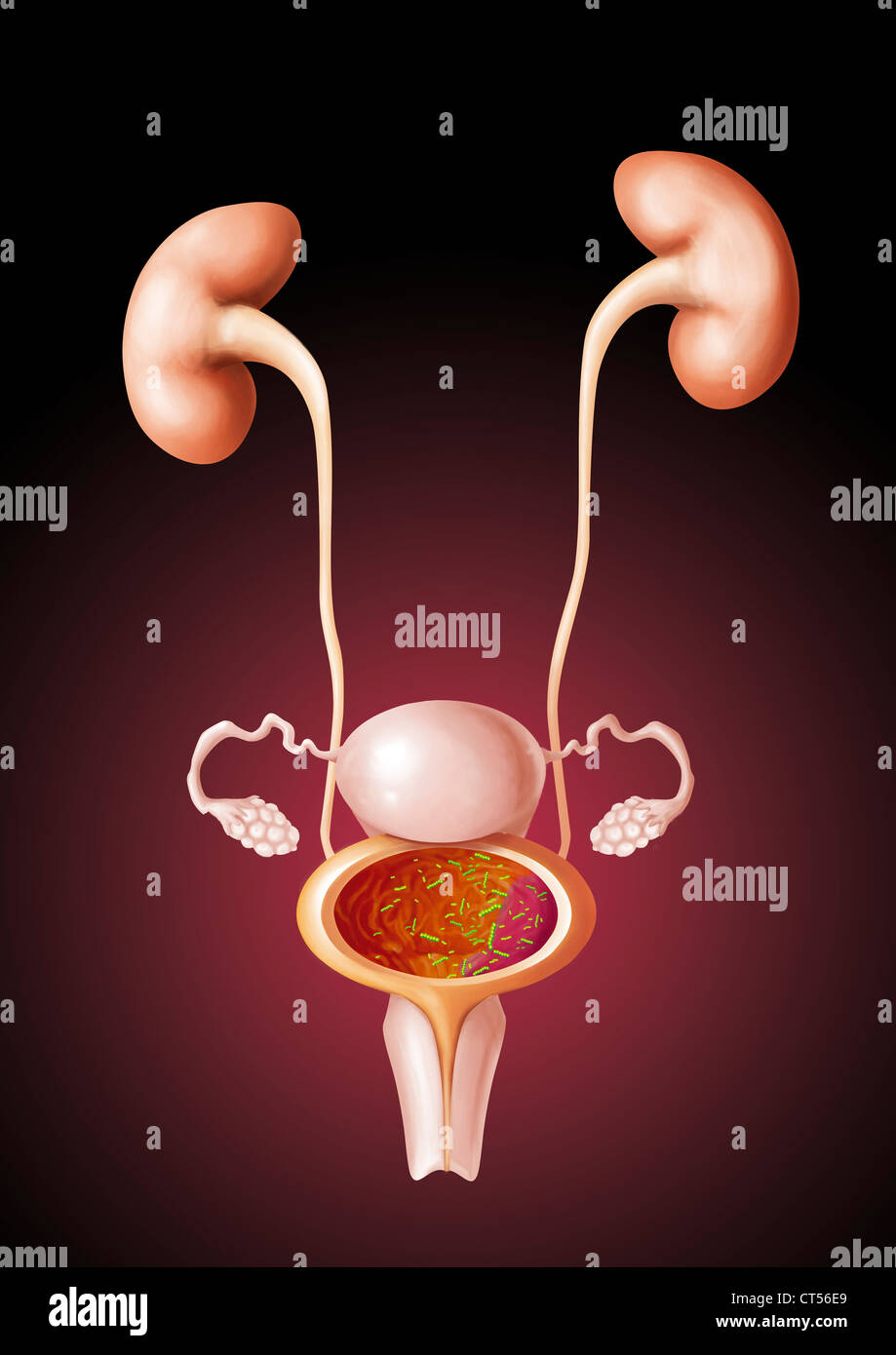 Urinary tract infection bacteria hi-res stock photography and images ...