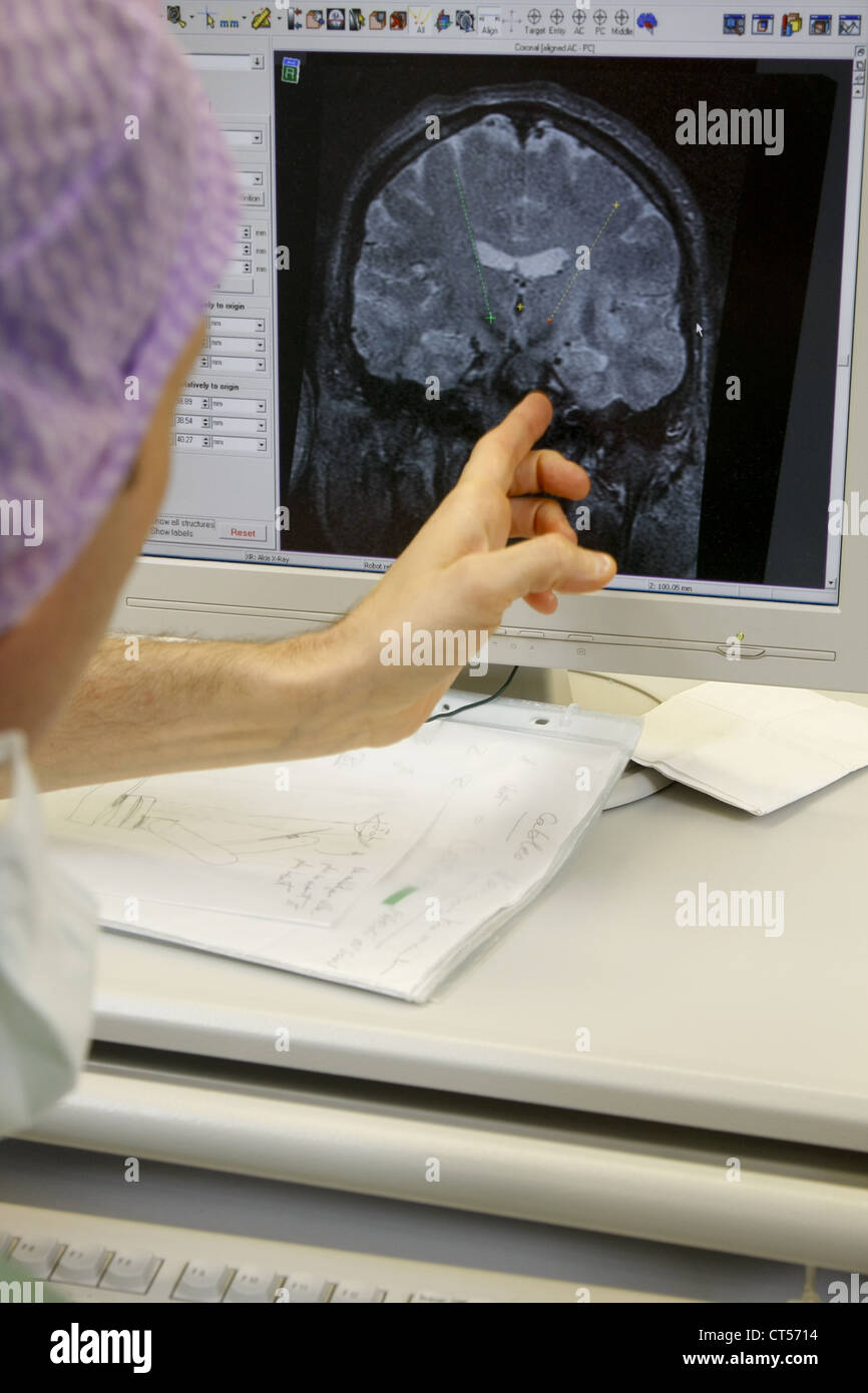 BRAIN ELECTROSTIMULATION, NMR Stock Photo - Alamy