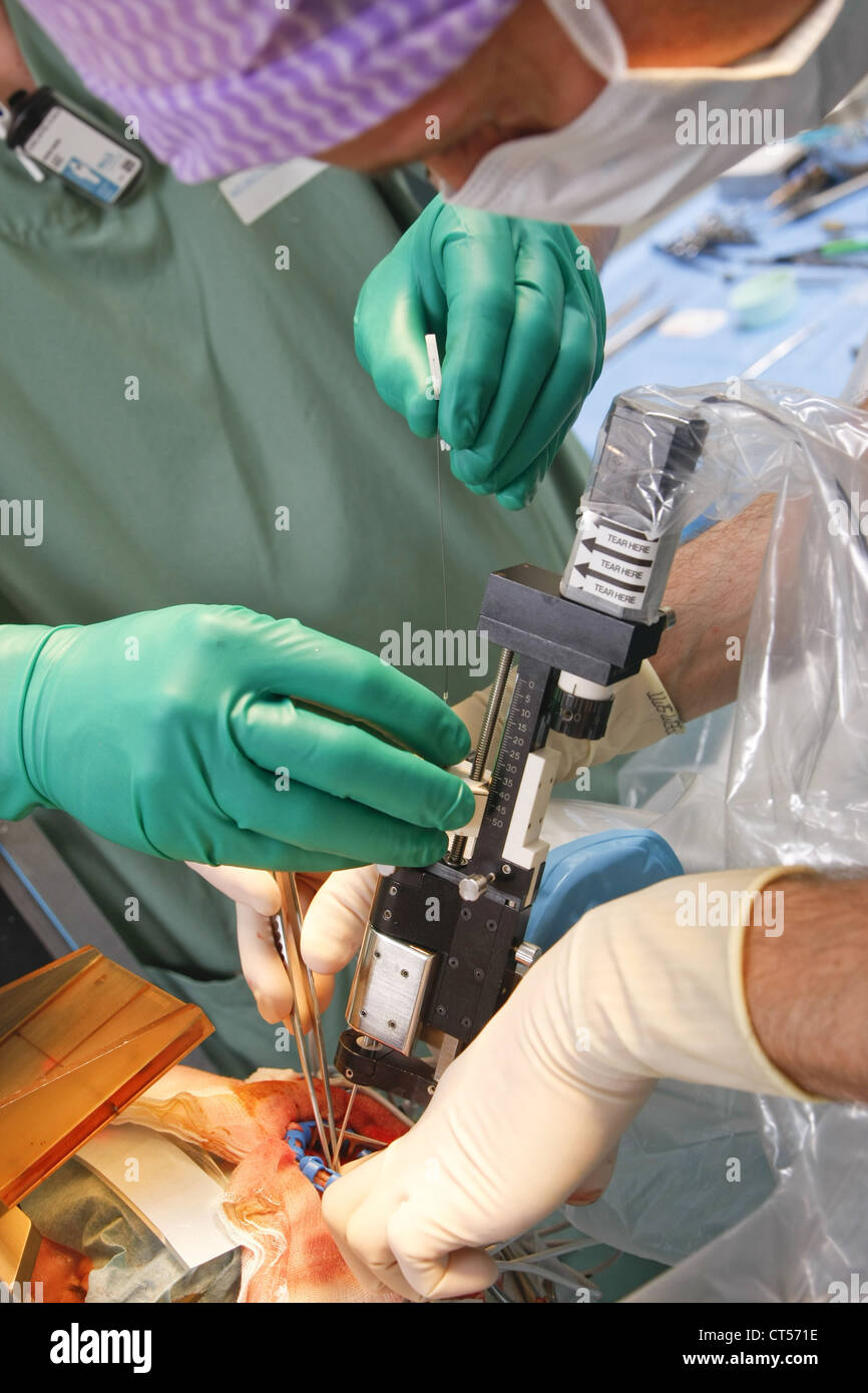 Stereotactic brain surgery hi-res stock photography and images - Alamy