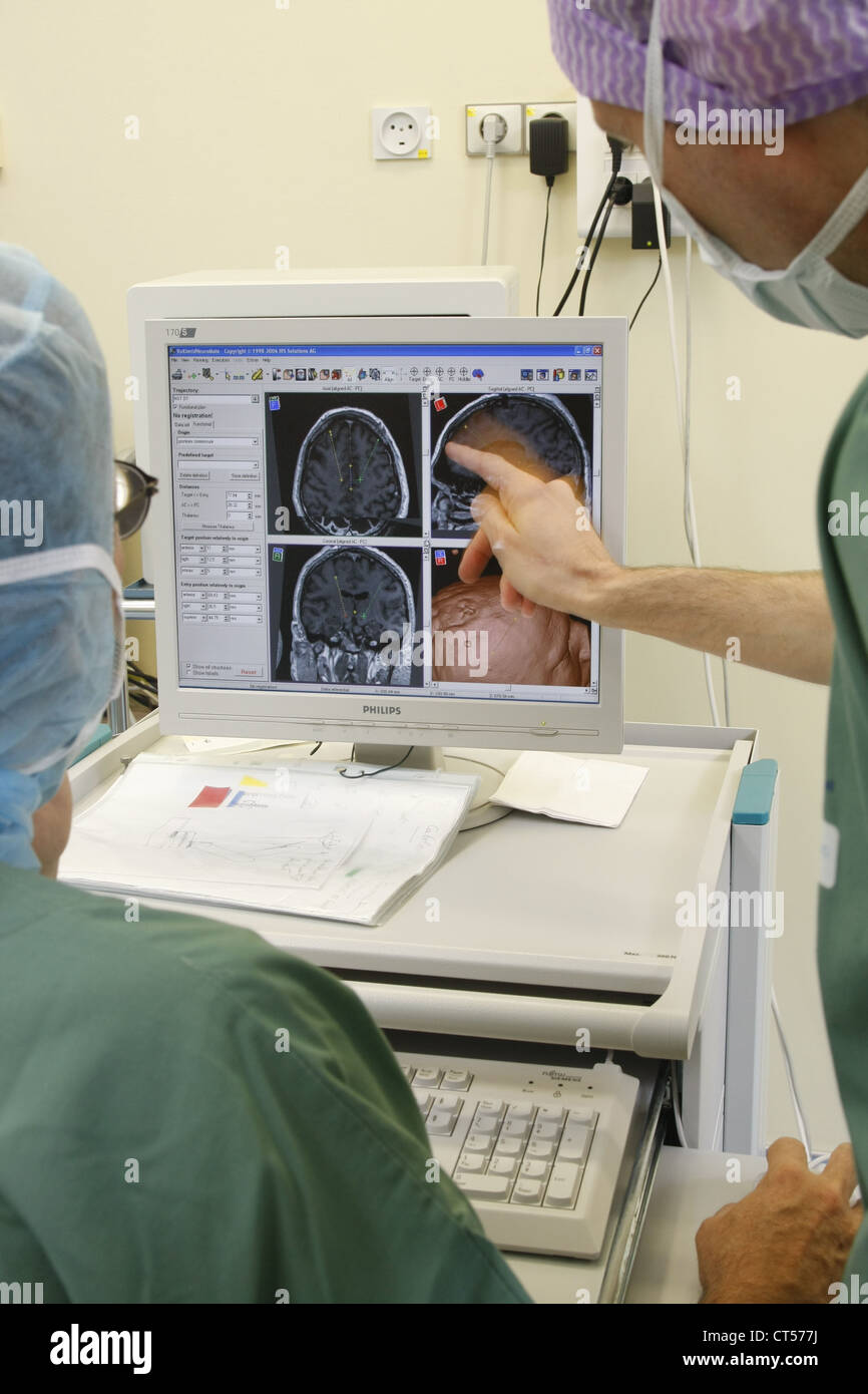 BRAIN ELECTROSTIMULATION, NMR Stock Photo - Alamy