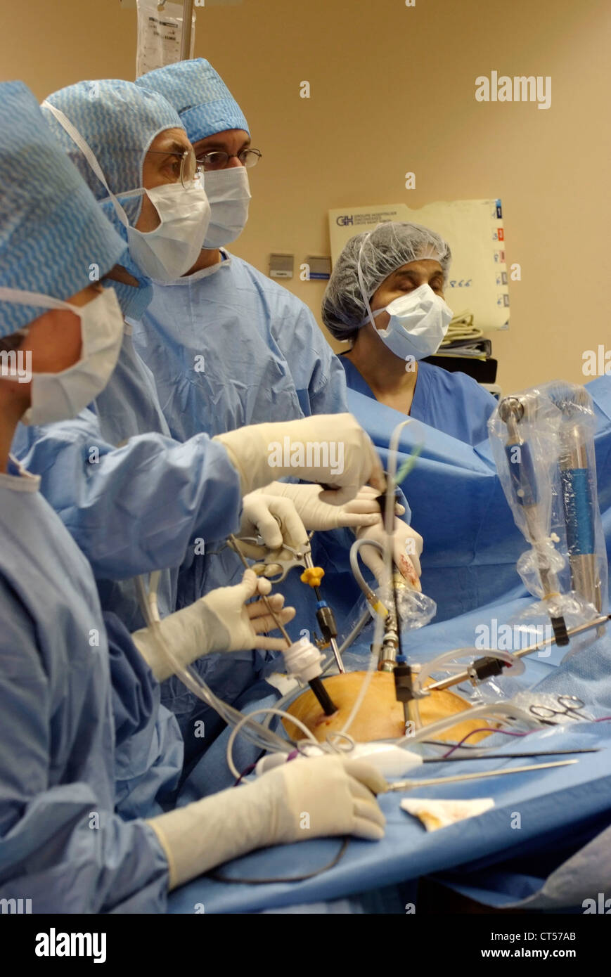 Bowel resection hi-res stock photography and images - Alamy