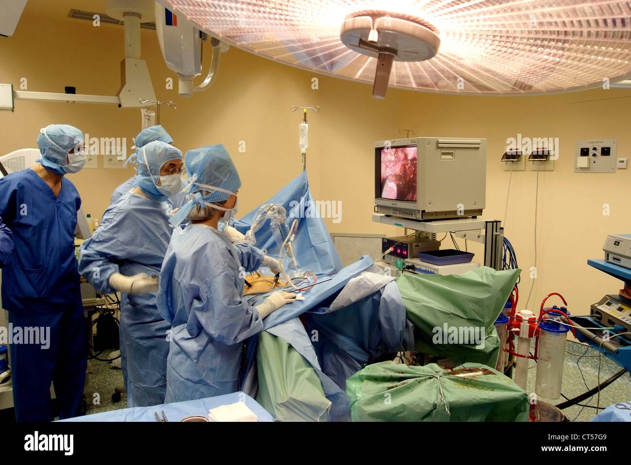 Bowel resection hi-res stock photography and images - Alamy