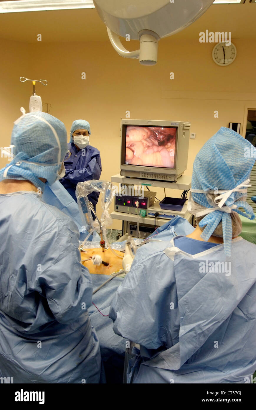 Bowel resection hi-res stock photography and images - Alamy