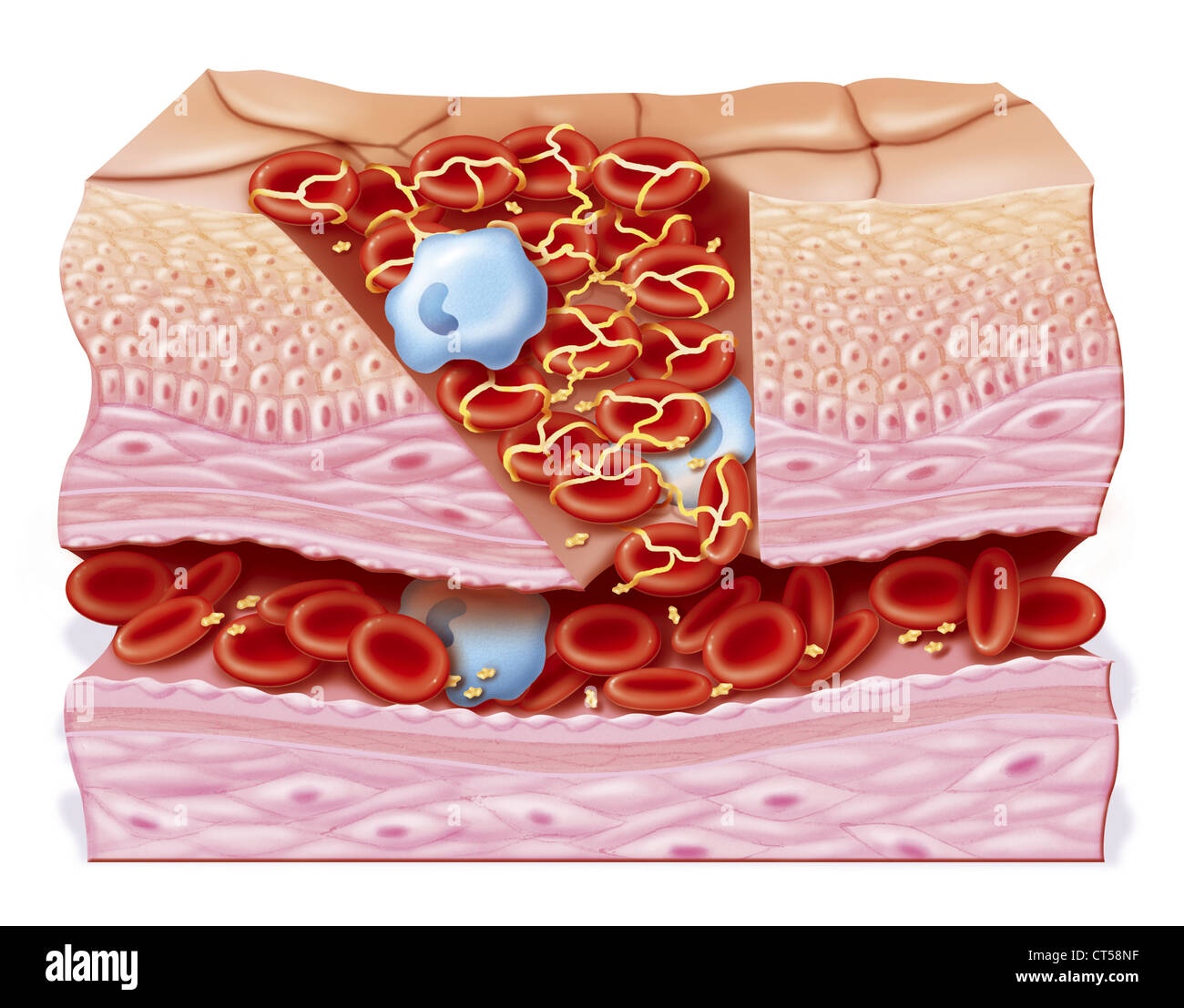 Wound healing drawing hi-res stock photography and images - Alamy