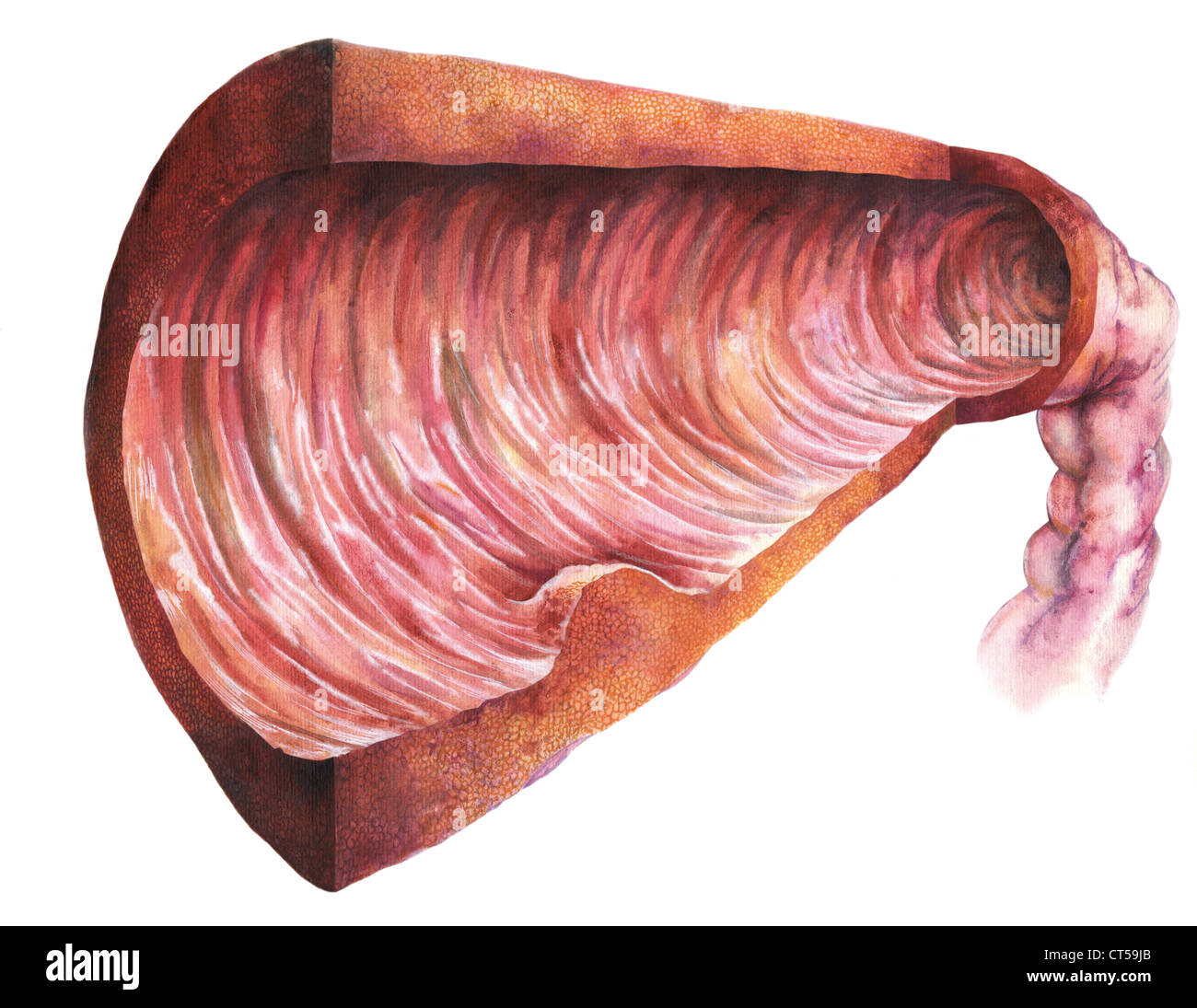 COLON POLYP, DRAWING Stock Photo - Alamy