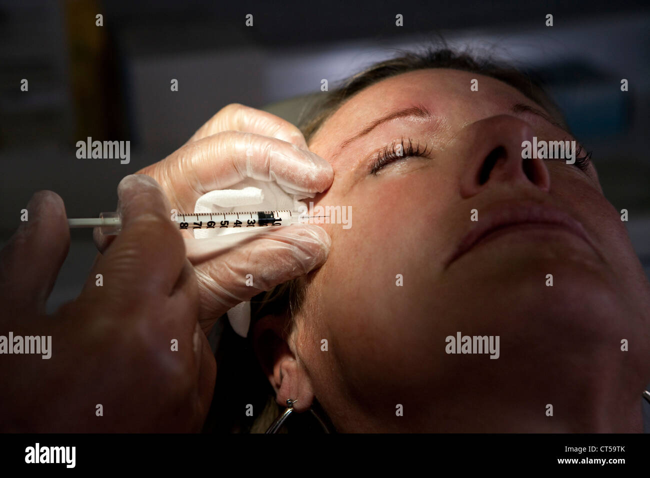 BOTOX TREATMENT, WOMAN Stock Photo - Alamy