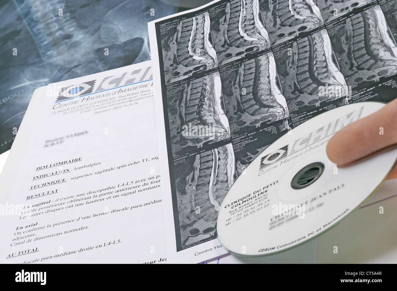 SPINAL COLUMN, MRI Stock Photo - Alamy