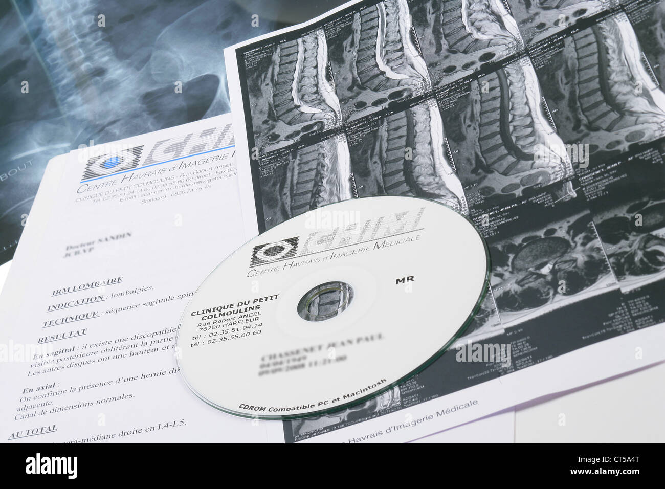 SPINAL COLUMN, MRI Stock Photo - Alamy