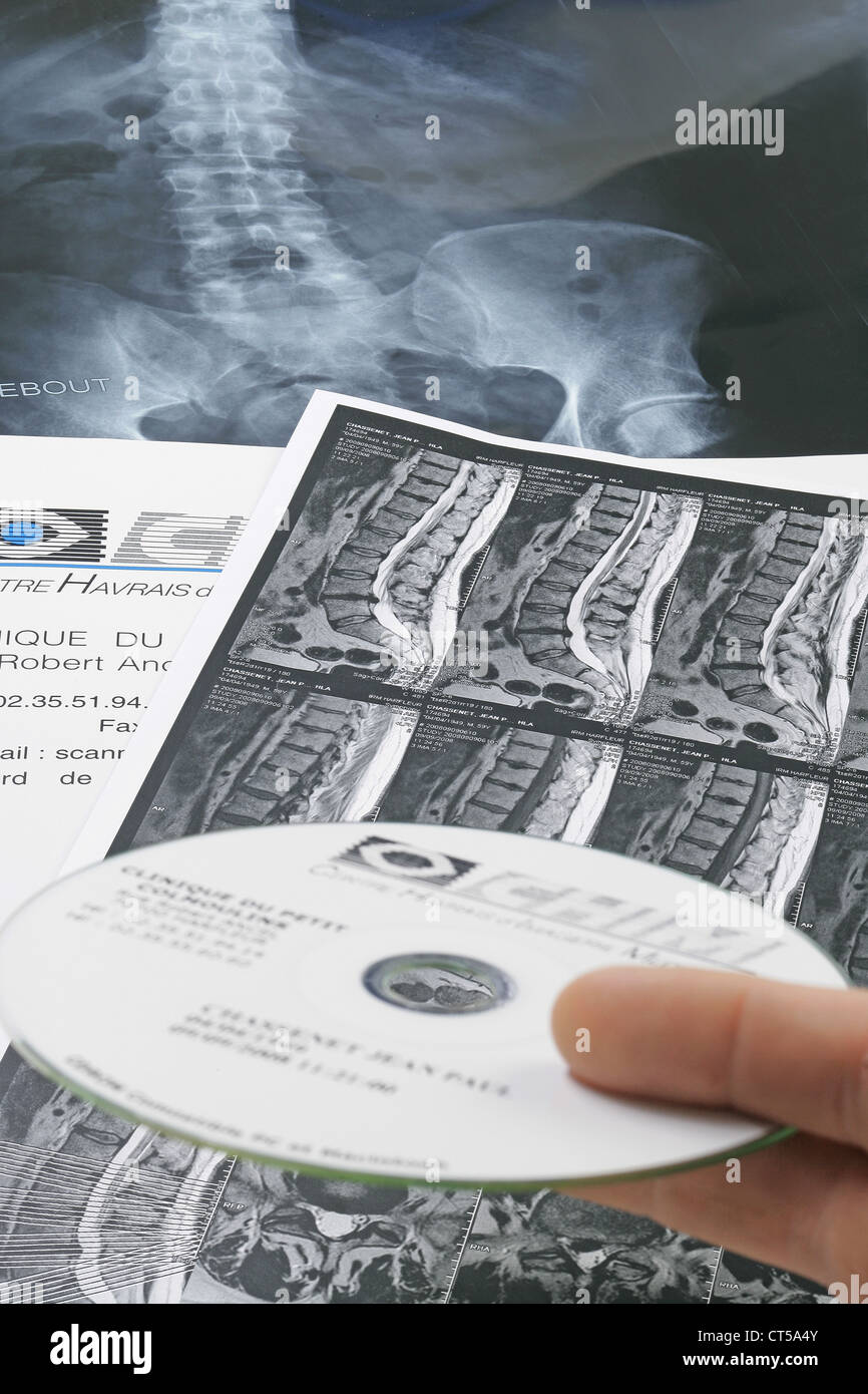 SPINAL COLUMN, MRI Stock Photo - Alamy